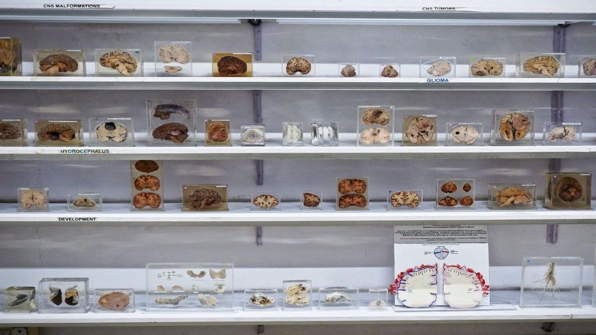 Only Museum In India Having Real Human Brains in Bangalore - Nativeplanet